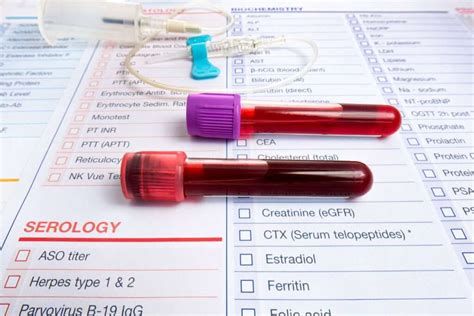 How To Understand Your Serology Test Report A Complete Guide Healtether Health