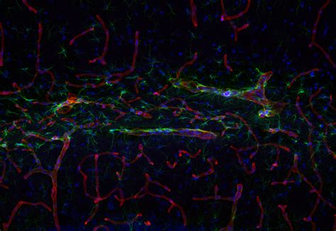 Histosure Collagen Type Iv