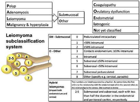 Classi Fi Cation System Including Leiomyoma Subclassi Fi Cation System