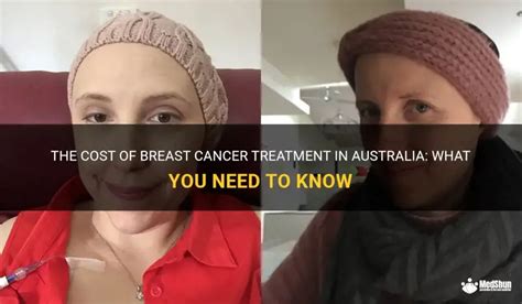 The Cost Of Breast Cancer Treatment In Australia What You Need To Know