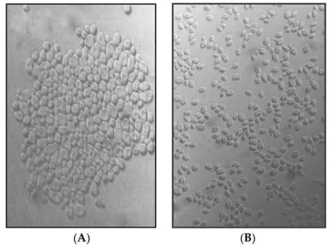 Yeast Flocculation—sedimentation And Flotation