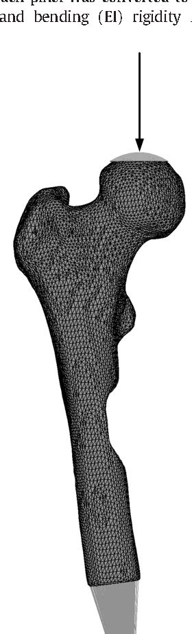 Figure 1 From Finite Element Analysis And Ct Based Structural Rigidity Analysis To Assess