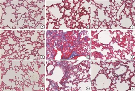 Masson染色和he染色区别 噗啦噗啦实验室