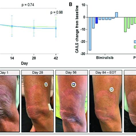 Clinical Efficacy Of Bimiralisib 20 Gel Compared To Placebo By