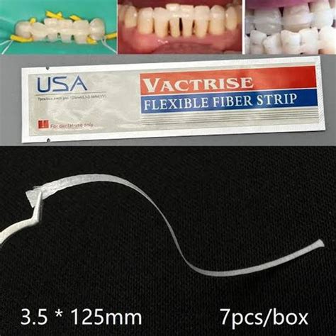 Jual Dental Fiber Splinting Splint Strip Endo Splinting Gigi Goyang Kota Makassar Keydent
