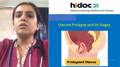 Prolapsed Uterus Stages