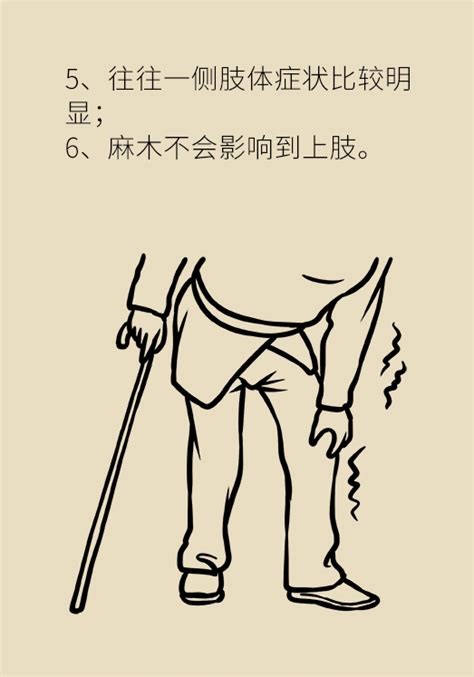 别以为手脚麻没啥事，弄不好就是这个大病！ 知乎