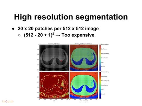 A Pixel To Pixel Segmentation Method Of Dild Without Masks Using Cnn