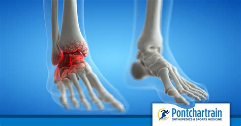 Sprained Ankle Vs Broken Ankle How To Tell The Differ