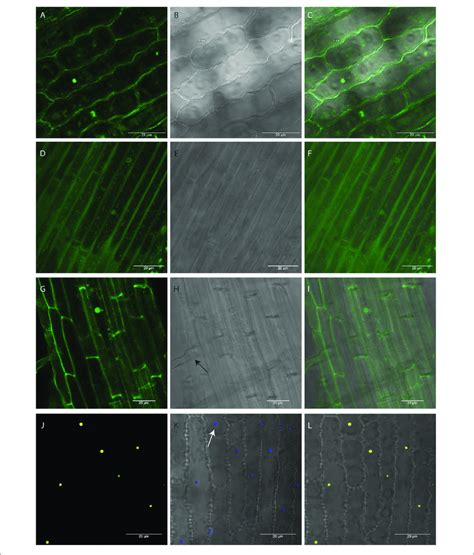 Transient Expression Of Psite 2ca Empty Gfp Vector Construct And Download Scientific
