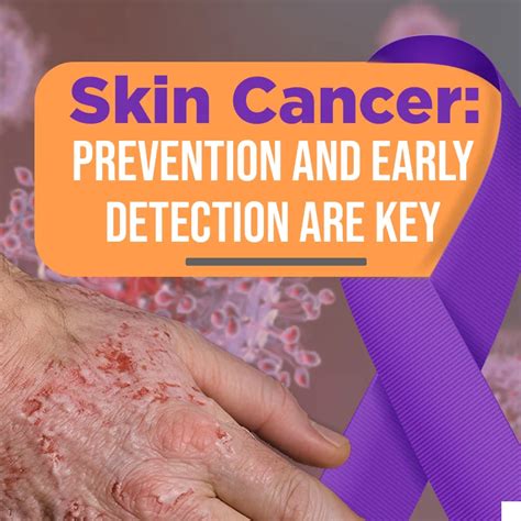 Skin Cancer Prevention And Early Detection Are The Key