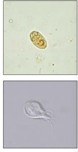 Lecture 10 Introduction To Protozoa And Flagellates Flashcards Quizlet