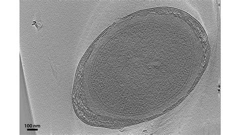 87 Monoderm Spores Atlas Of Bacterial And Archaeal Cell Structure