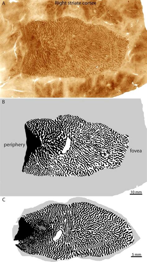 Comparison Of Ocular Dominance Columns In The Human And Macaque A Co Download Scientific