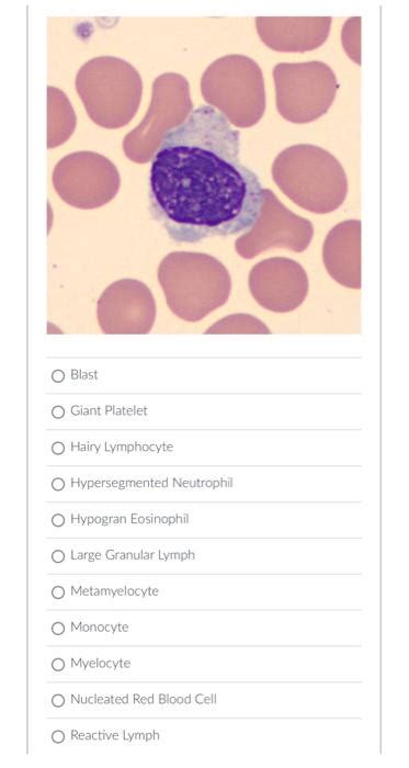 Solved Blast Giant Platelet Hairy Lymphocyte Hypersegmented
