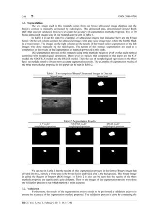 Comparison Of Three Segmentation Methods For Breast Ultrasound Images Based On Level Set And
