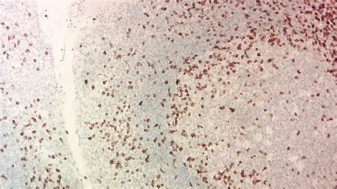 Immunohistochemistry Ihc Stain Purpose Principle And Protocol