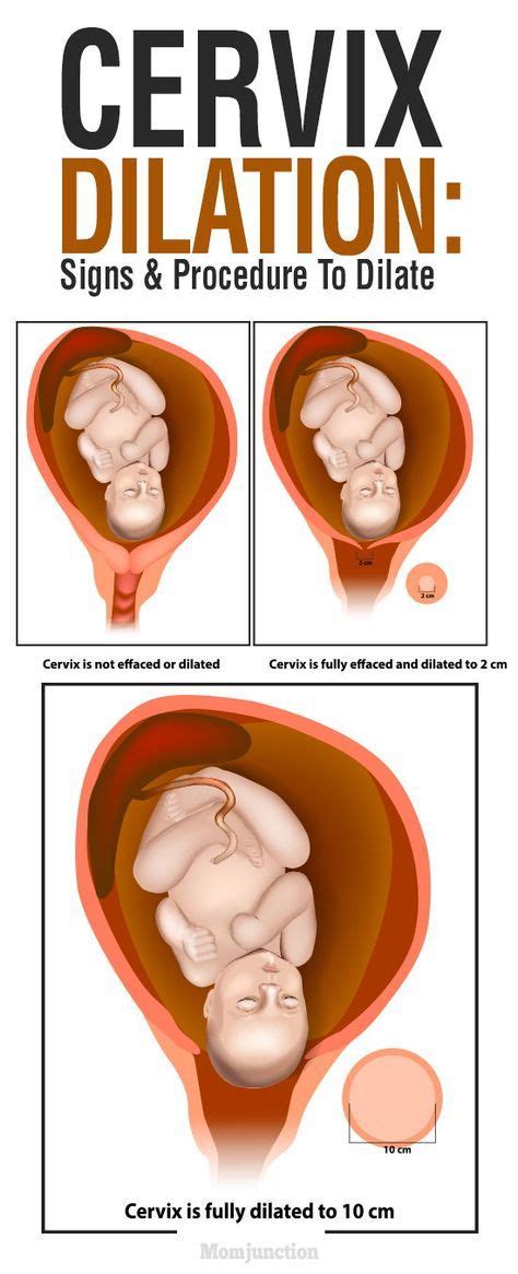 Cervix Dilation Chart Signs Stages And Procedure To Check Artofit