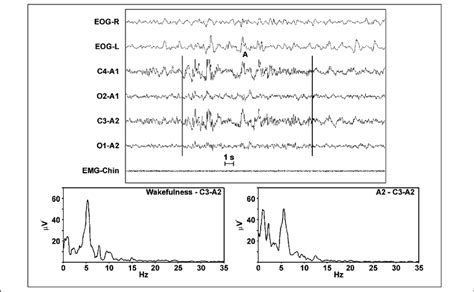 cyclic alternating pattern a2 subtype characterized by predominant download scientific diagram