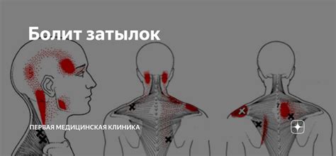 Болит затылок Первая Медицинская Клиника Дзен