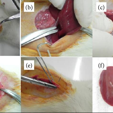Technique Of 70 Hepatectomy A Median Laparotomy And Installation Download Scientific