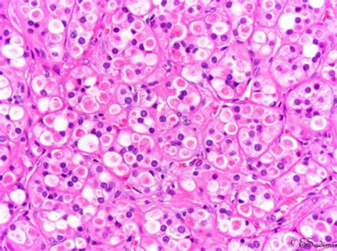 Adrenal Gland Flashcards Quizlet