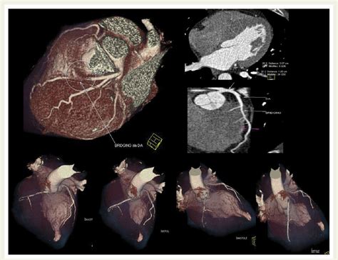 Figure 1 From Role Of Multimodality Cardiac Imaging In The Management Of Patients With