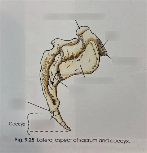 Lateral Sacrum Diagram Quizlet