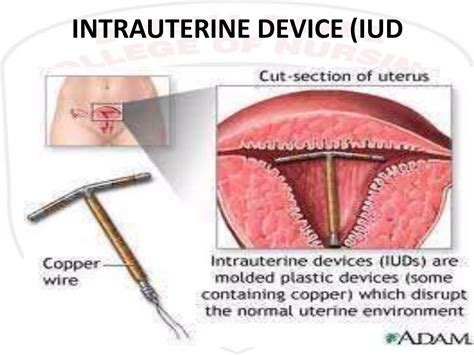 Emergency And Terminal Contraception PPSX Pregnancy Reproductive Health