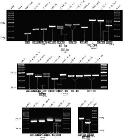 Splicing Effects Of Myo5b Variants Based On Minigene Splicing Assays Download Scientific