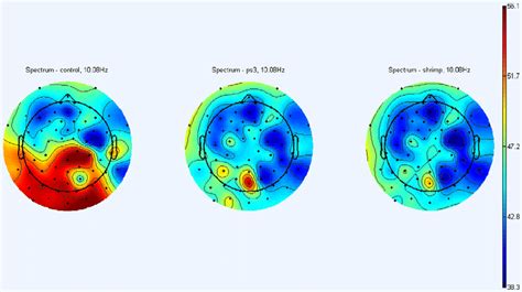A Summary EEG Scalp Map At Hz The Mid Point For Alpha Activity Download Scientific Diagram