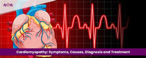 Cardiomyopathy Symptoms Causes Diagnosis And Treatment