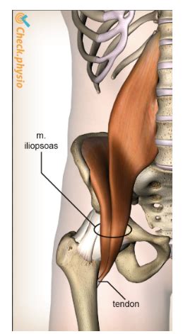 Hip Stress Fracture Sportsfit Physio And Health