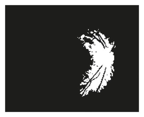 Final Segmentation Of The Optical Disk Region Download Scientific
