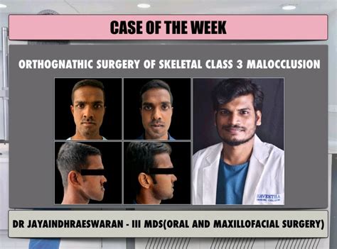 Best Case Of The Week Skeletal Class Iii Malocclusion Correction — Oral And Maxillofacial Surgery