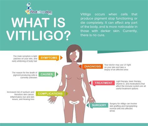 Vitiligo Symptoms Causes Treatment And Diagnosis Findatopdoc