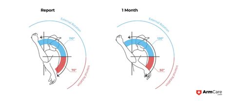 Issues With Passive Range Of Motion Testing ArmCare Issues With Passive Range Of Motion Testing ArmCare