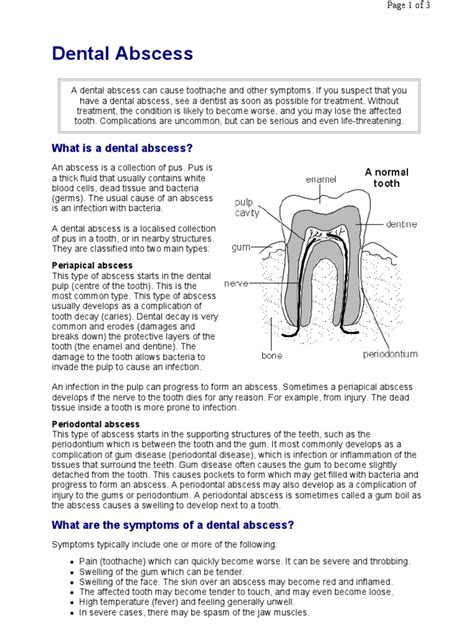 Dental Abscess Pdf Human Tooth Dentistry Free 30 Day Trial Scribd