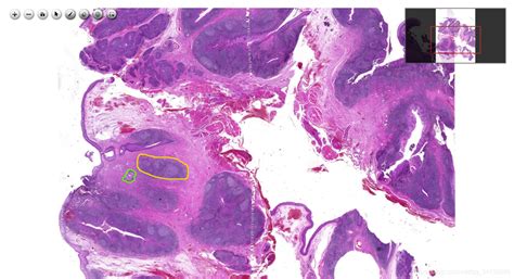 vue 集成openseadragon vue openreport csdn博客