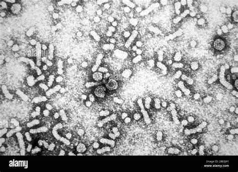 Hepatitis A Virus Under A Microscope
