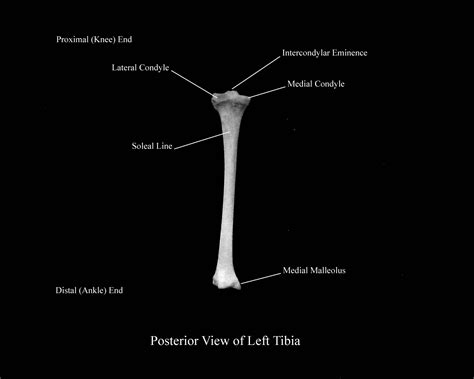 Posteriortibia