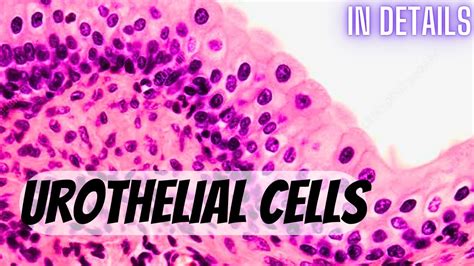 Urothelial Cells In Details Cytology Part 86 Youtube