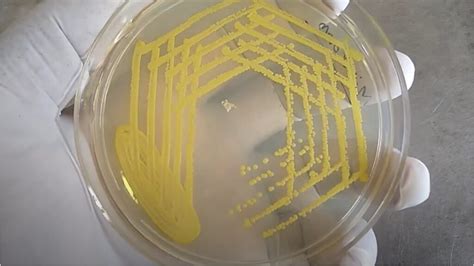 Colony Morphology Of Bacteria Introduction Types And Special
