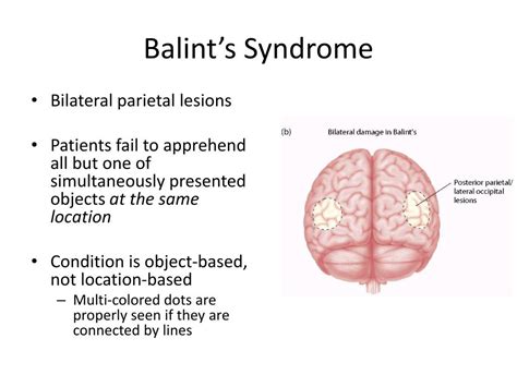 Ppt Attention Orienting System And Associated Disorders Powerpoint Presentation Id2836794