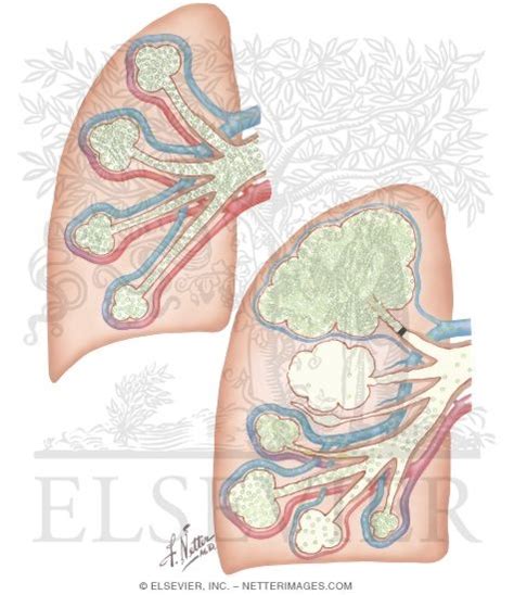 Lungs Lungs Netter