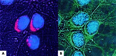 Armands Blog Mycoplasma Dapi Staining