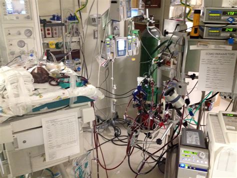 Ecmo Machine