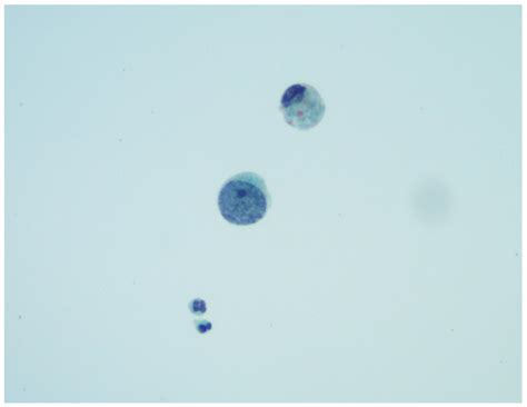 Trichomonas Vaginalis Slide