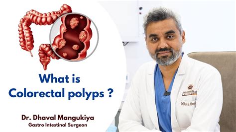 Colorectal Polyps Causes Signs And Symptoms Diagnosis And Treatment