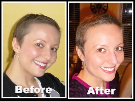 The Big C Can Suck It Post Chemo Haircut